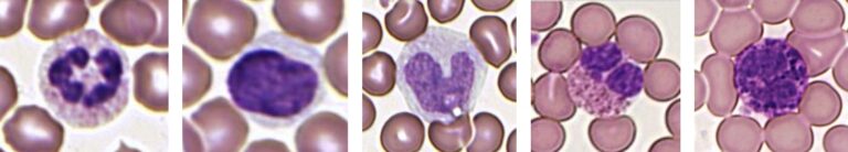 NOUL Blog | CBC Test Normal Ranges: 5 WBC Types and Key Blood Cell Counts