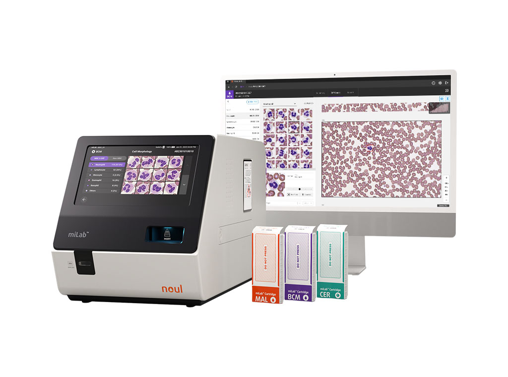 NOUL Blog | nRBC Blood Test: Why Accurate Detection is Critical and How ...