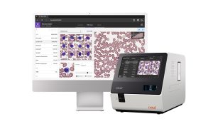 NOUL Blog | Comprehensive Guide to Blood Indices: Understanding MCHC ...