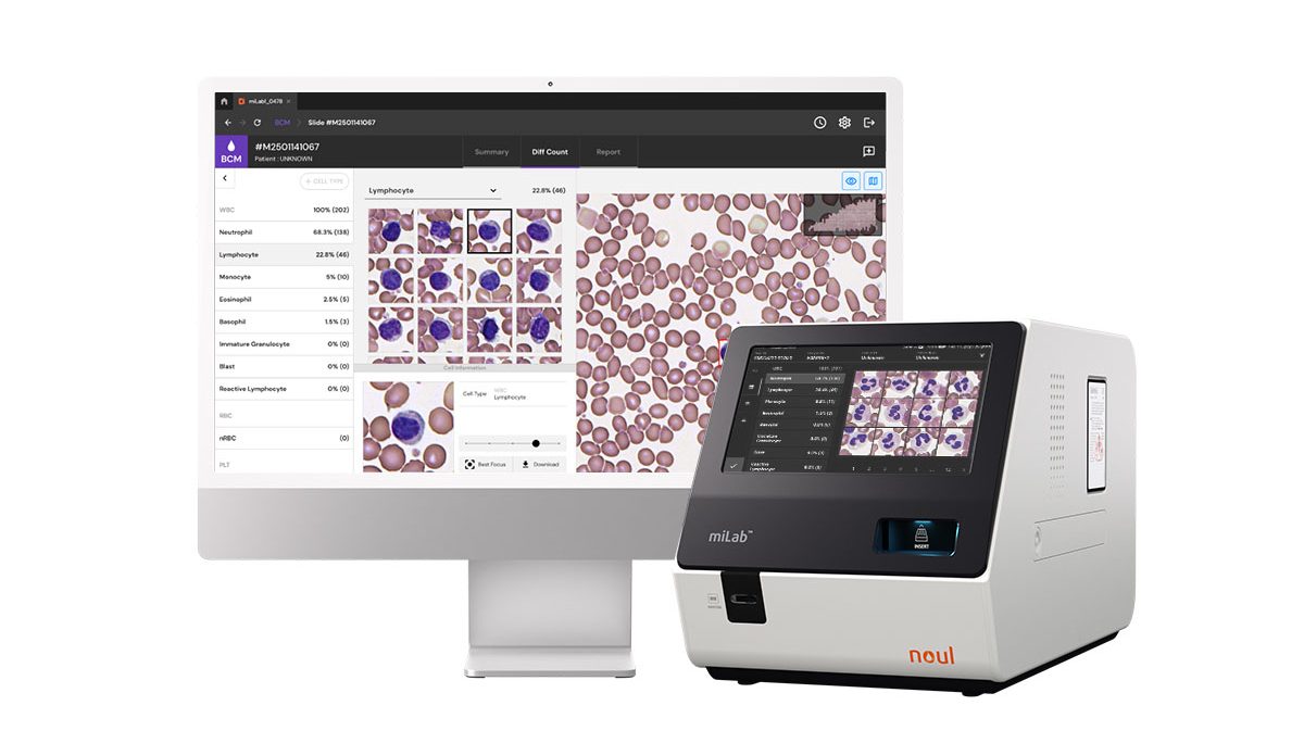NOUL Blog | Comprehensive Guide to Blood Indices: Understanding MCHC ...