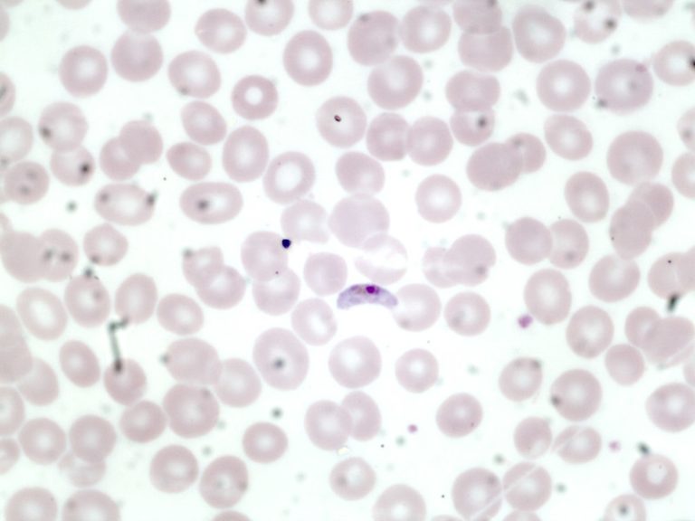 NOUL Blog | Trophozoites, Schizonts & Gametocytes: Plasmodium ...