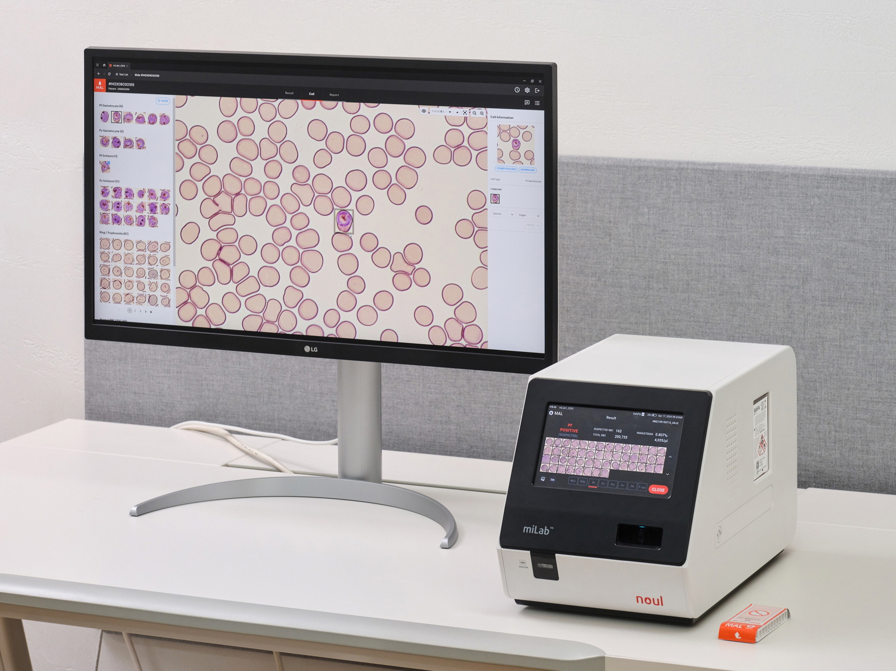 Noul | [Press Release] Noul Supplies AI Diagnostic Platform miLab™ to ...